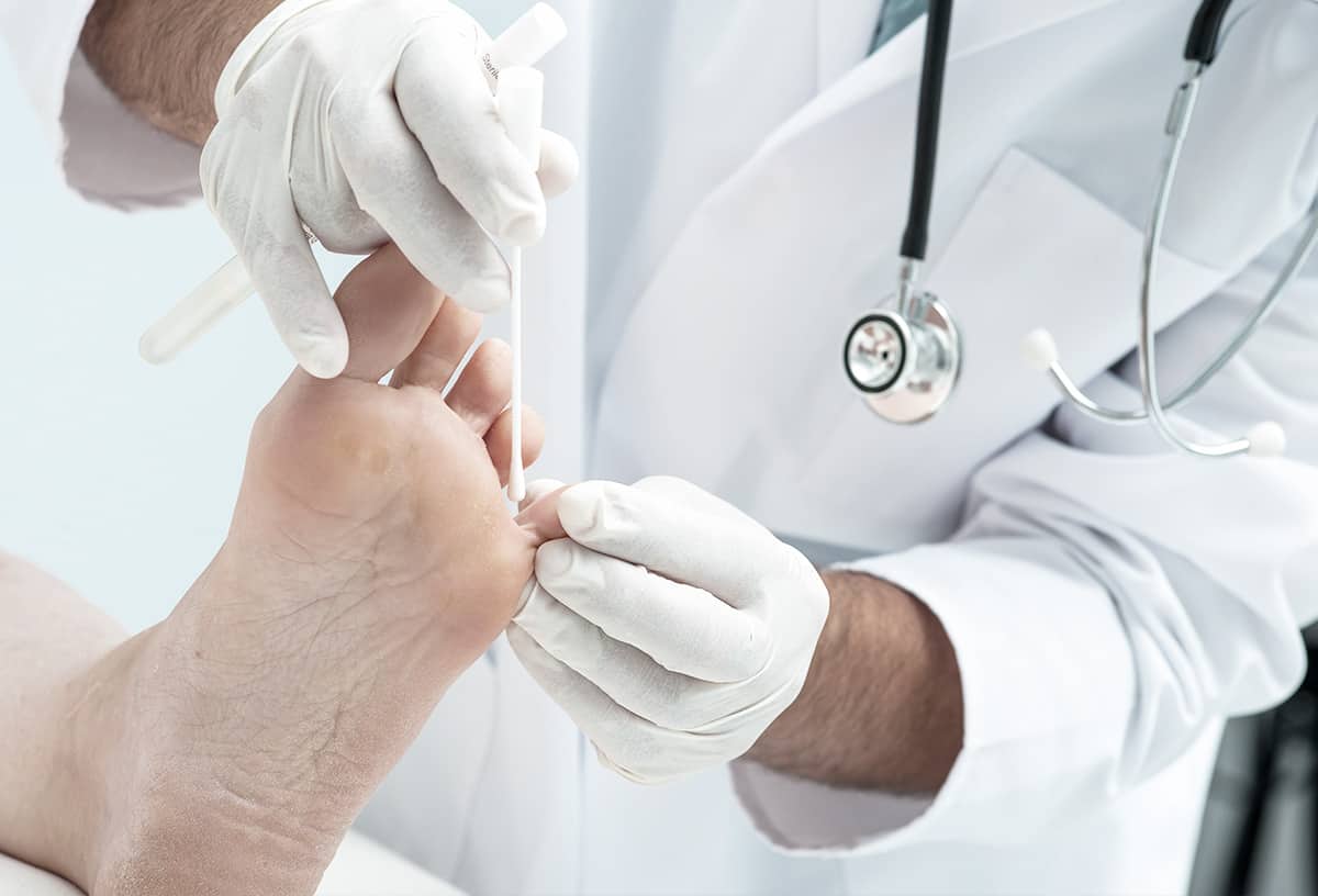 Behandlung von Pilzerkrankungen Haut & Nägel – Dr. Helene Krause ...